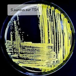 Tryptic Soy Agar (TSA) - Composition, Principle, Preparation, Results ...