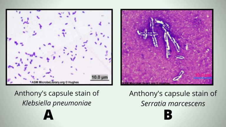 Capsule Staining - Procedure, Principle, Result - Biology Notes Online