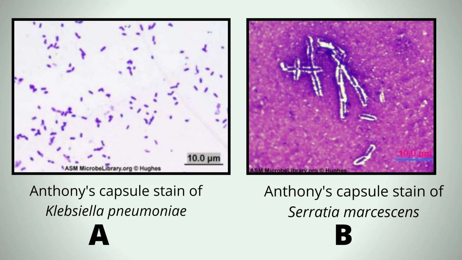 Capsule Staining - Procedure, Principle, Result - Biology Notes Online