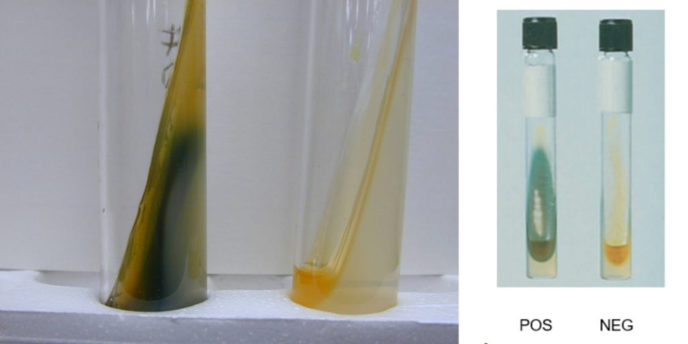Phenylalanine Deaminase Test Principle, Procedure, Result - Biology ...