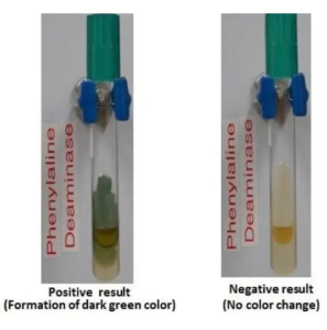 Phenylalanine Deaminase Test Principle, Procedure, Result - Biology ...