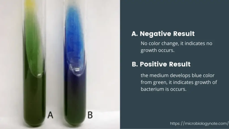 IMViC test procedure, Purpose, Result, and Organism List. - Biology ...