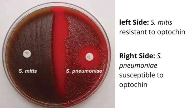 Optochin Susceptibility Test - Principle, Objective, Procedure And ...