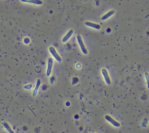 Types of Microorganisms In Pond Water - Biology Notes Online