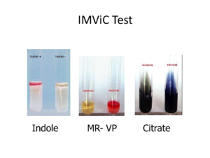 IMViC Test - Principle, Procedure, Result, Uses, Examples - Biology ...
