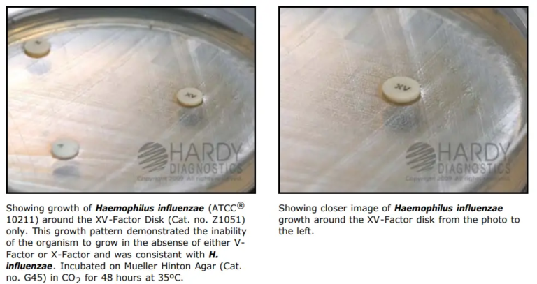 X and V factor Test - Principle, Purpose, Procedure, Result - Biology ...