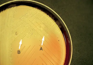 Bile Solubility Test - Principle, Procedure, Result, Uses - Biology ...