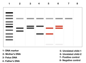 DNA Fingerprinting - Definition, Steps, Methods, Applications - Biology ...