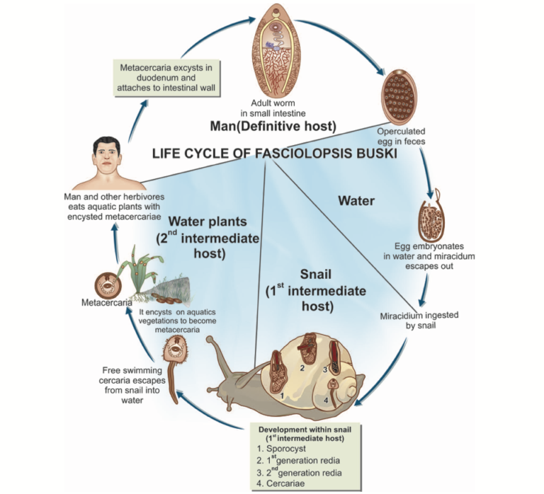 Fasciolopsis Buski - Morphology, Life Cycle, Pathogenicity, Diagnosis ...