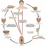 Fasciolopsis Buski - Morphology, Life Cycle, Pathogenicity, Diagnosis ...