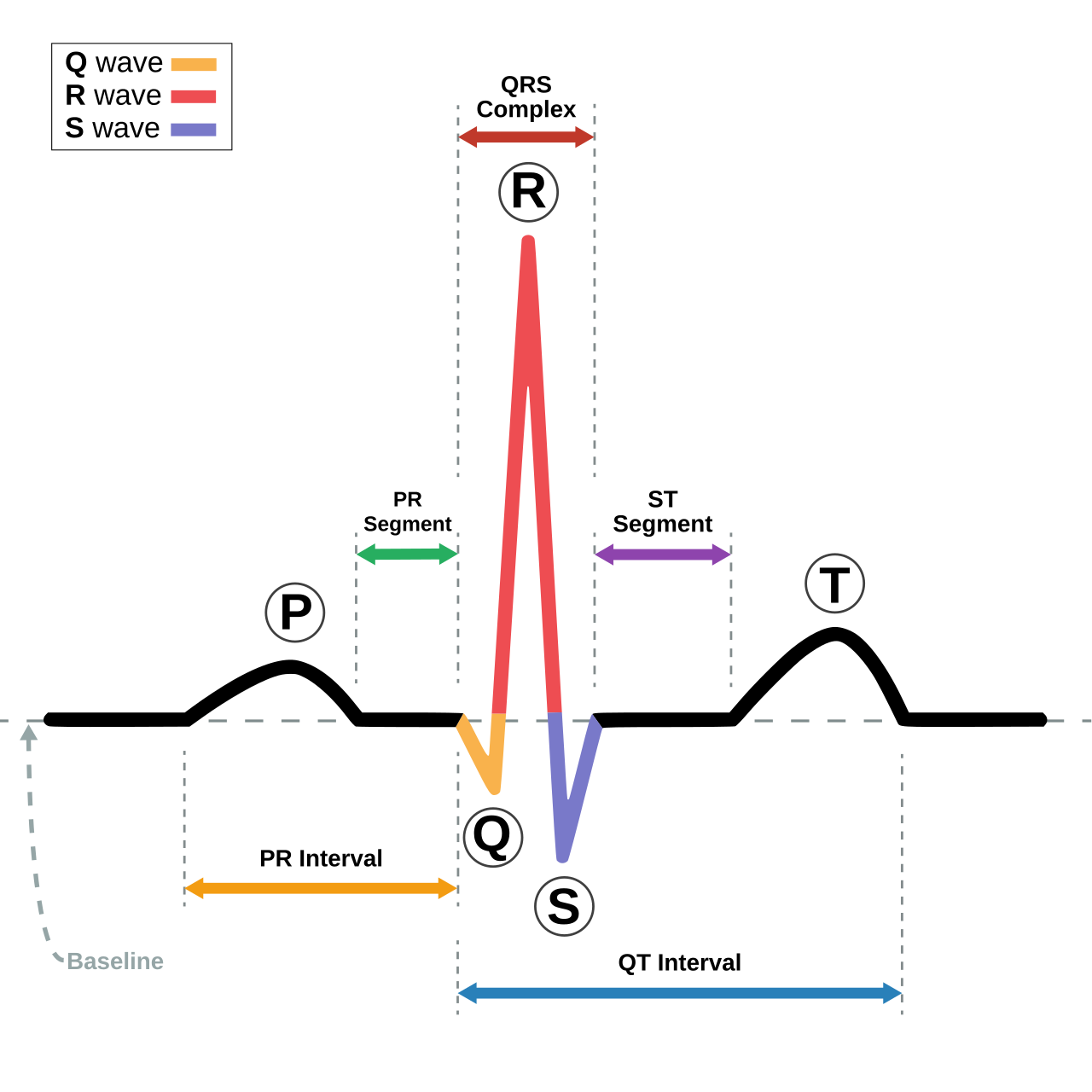 Electrocardiogram (ECG) - Purpose, Principle, Parts, Types, Procedure ...
