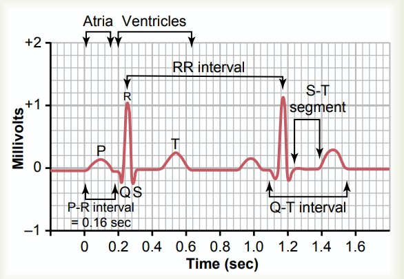 Electrocardiogram Ecg