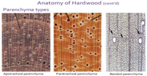 Wood - Axial and Ray parenchyma, Annual ring, Ring porous, Tylosis ...