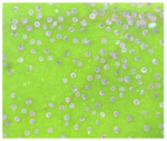 Secretory System In Plants - External Secretory And Internal Secretory ...