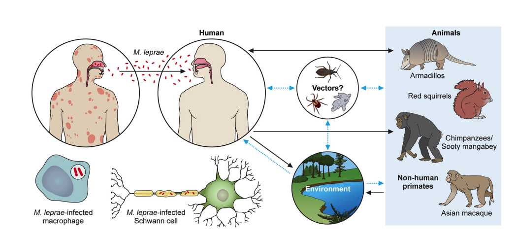 Neuropathogenesis Of Mycobacterium Leprae M Leprae Histoid Hansen's