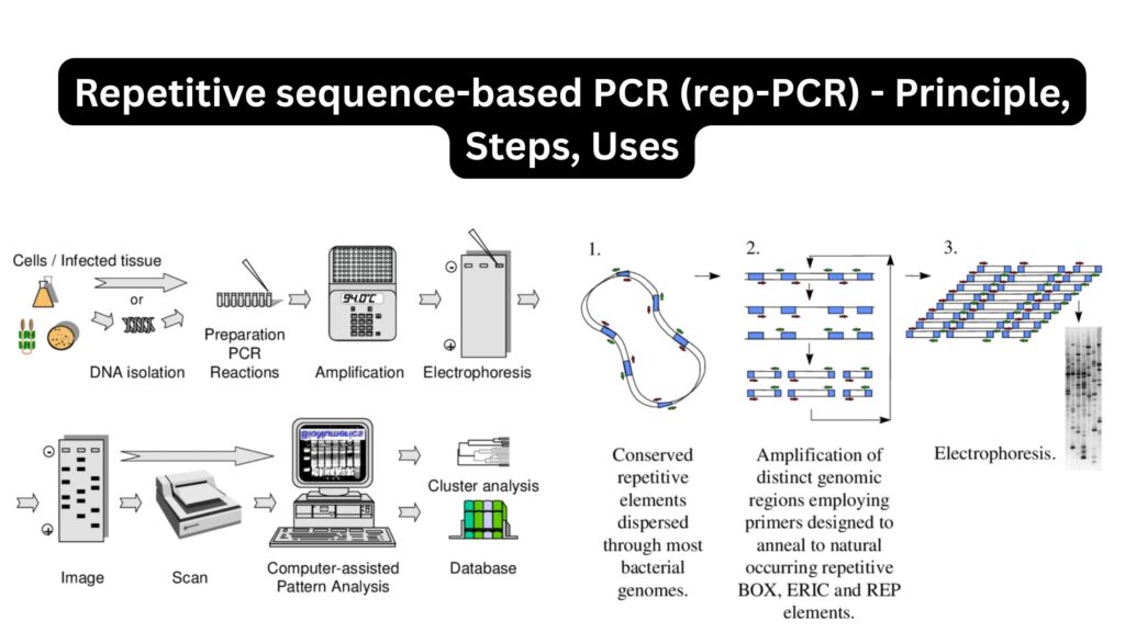 Repetitive sequence-based PCR (rep-PCR) - Principle, Steps, Uses ...