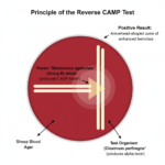 Reverse CAMP test - Principle, Procedure, Result, Uses - Biology Notes ...