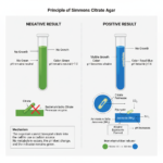 Simmons Citrate Agar - Principle, Composition, Procedure, Result, uses ...