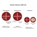 Reverse CAMP test - Principle, Procedure, Result, Uses - Biology Notes ...